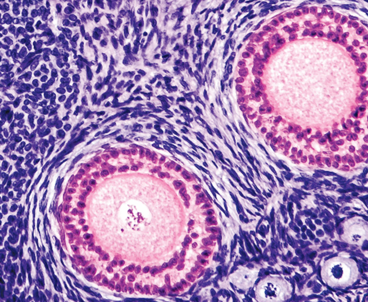 Engineering Fertility Options for Cancer Survivors: An Interview with ...